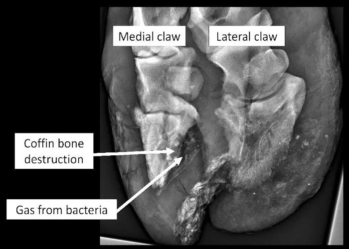 Catastrophic foot abscess: A case study