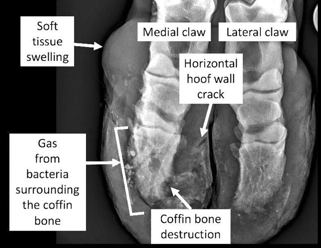 Catastrophic foot abscess: A case study