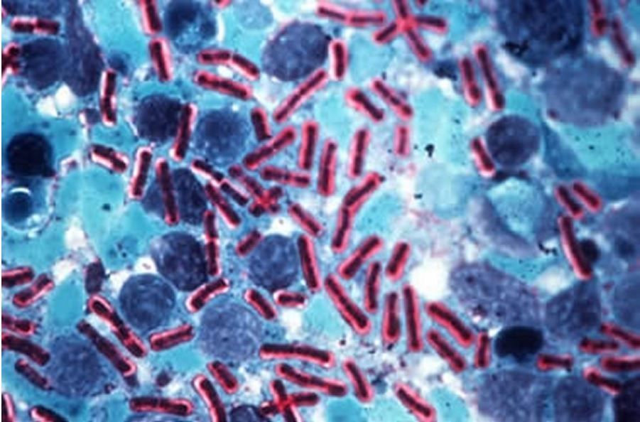 Check cattle frequently for signs of anthrax