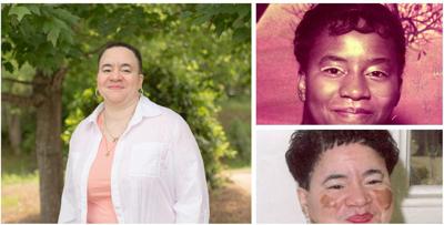 Alpine native shares story about living with vitiligo (with photos ...