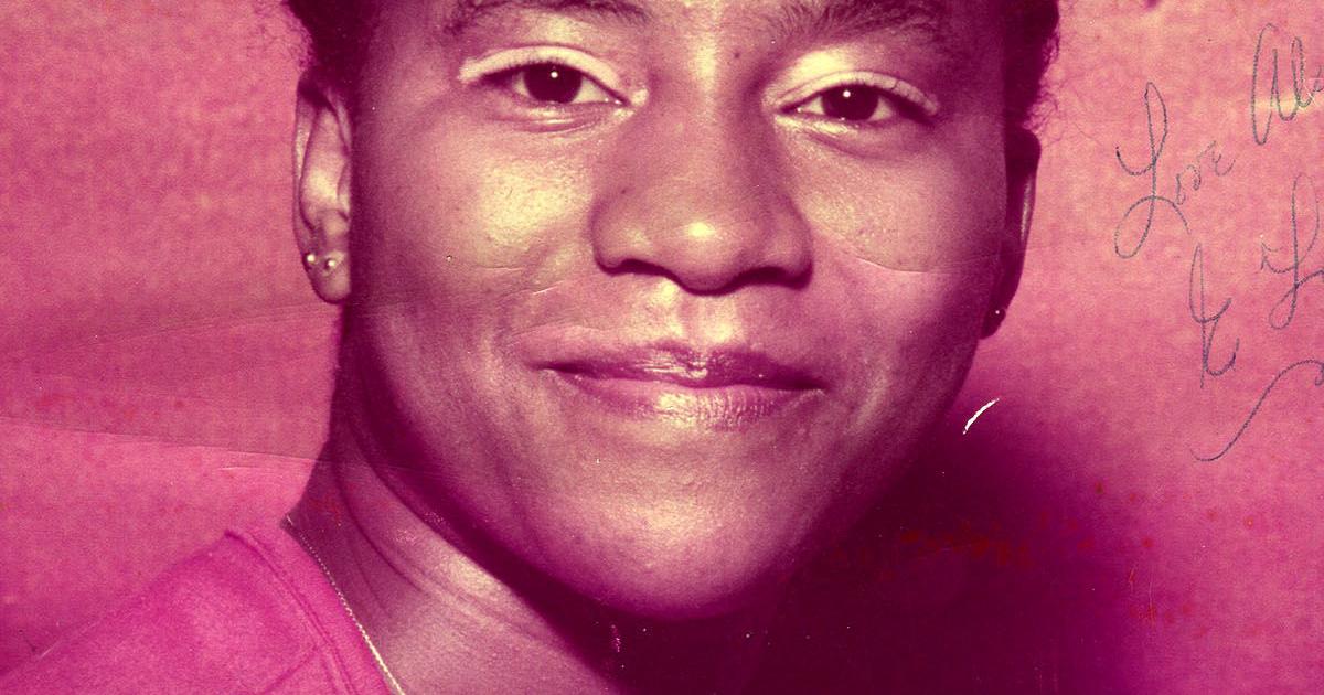 Alpine native shares story about living with vitiligo (with photos ...