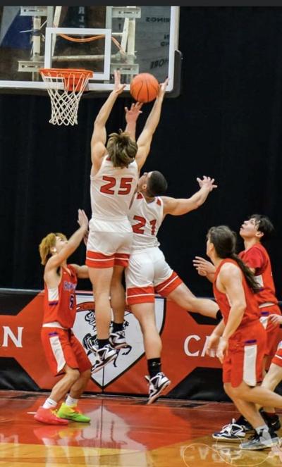 Bracing for boys brackets | High School | apg-wi.com