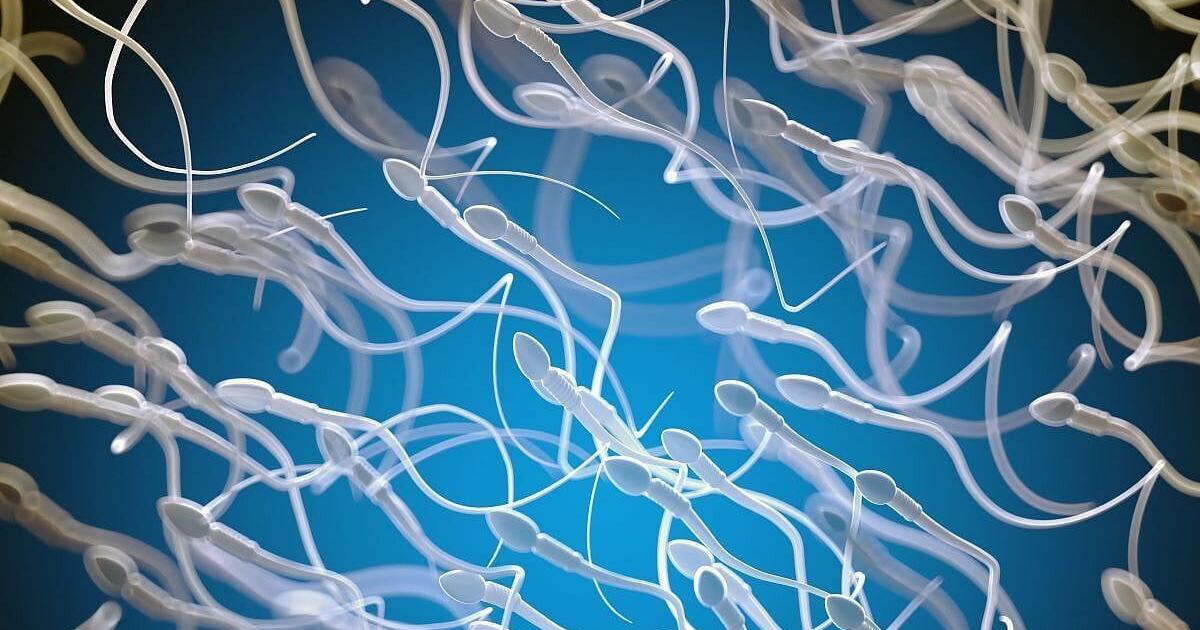 AI-Guided Sperm Analysis Results In First Successful Pregnancy | Health ...