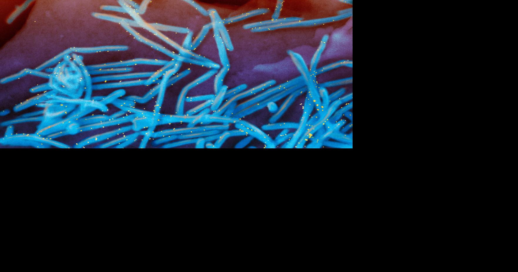 Winter virus season so far is not too bad despite concerns