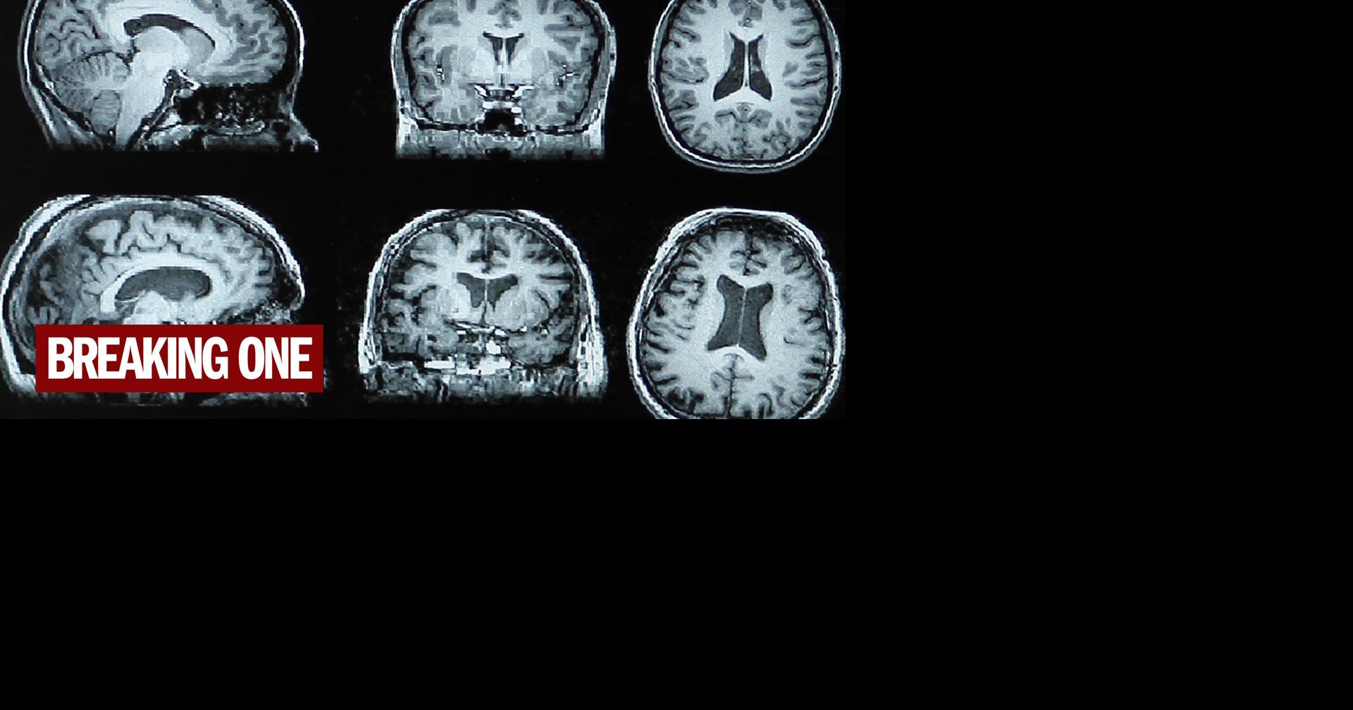 Scientists peek into opioid users' brains as they try to quit