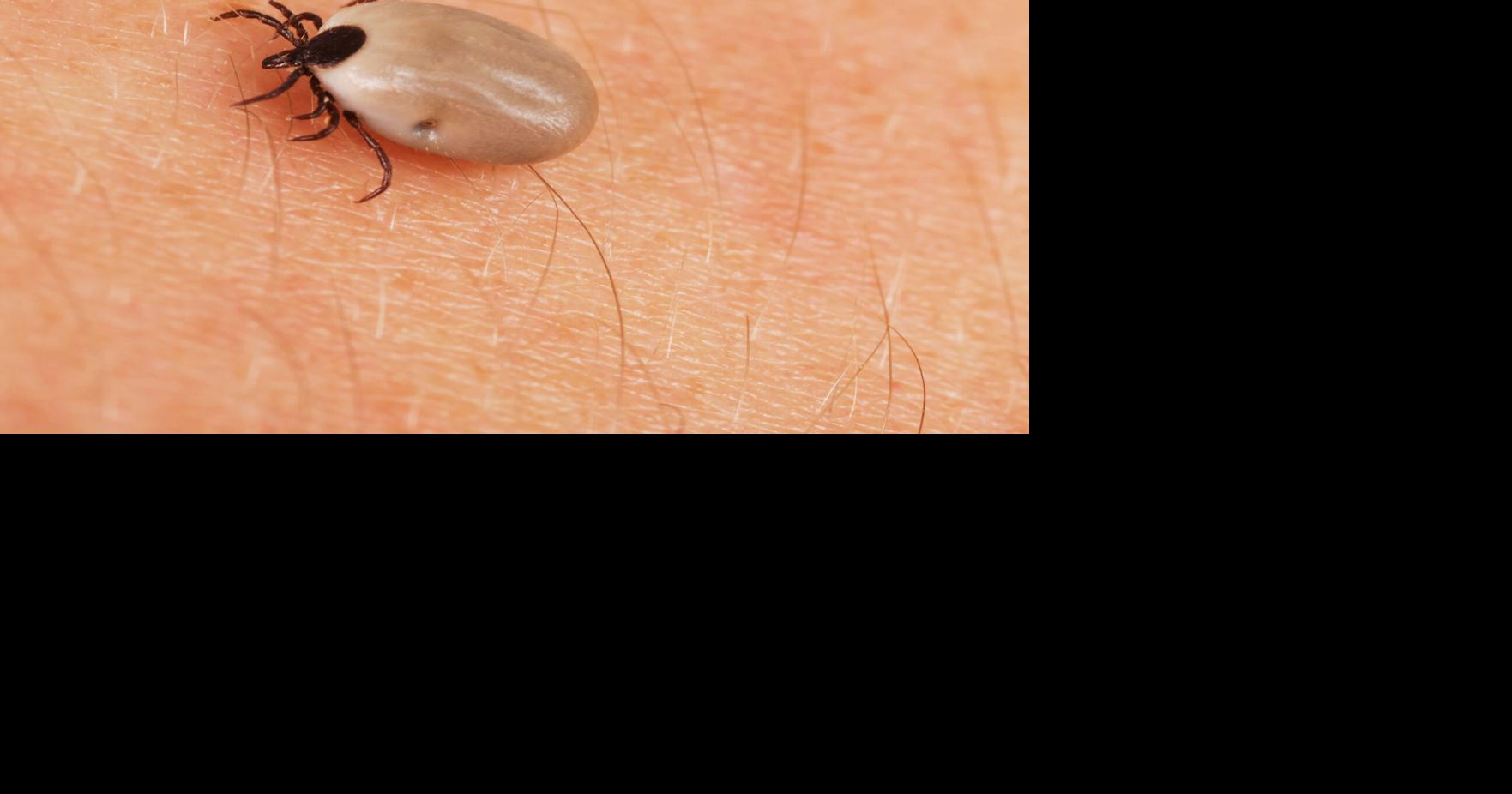Mayo Clinic Q and A: The risks of ticks | Hikes-bikes-trikes ...