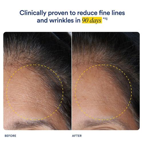 Clinical Trial Proves Ritual's HyaCera Reduces Fine Lines and Wrinkles ...