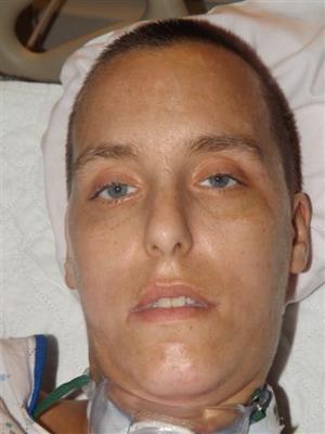 Unidentified woman emerges from 3-week coma | Archives | bdtonline.com