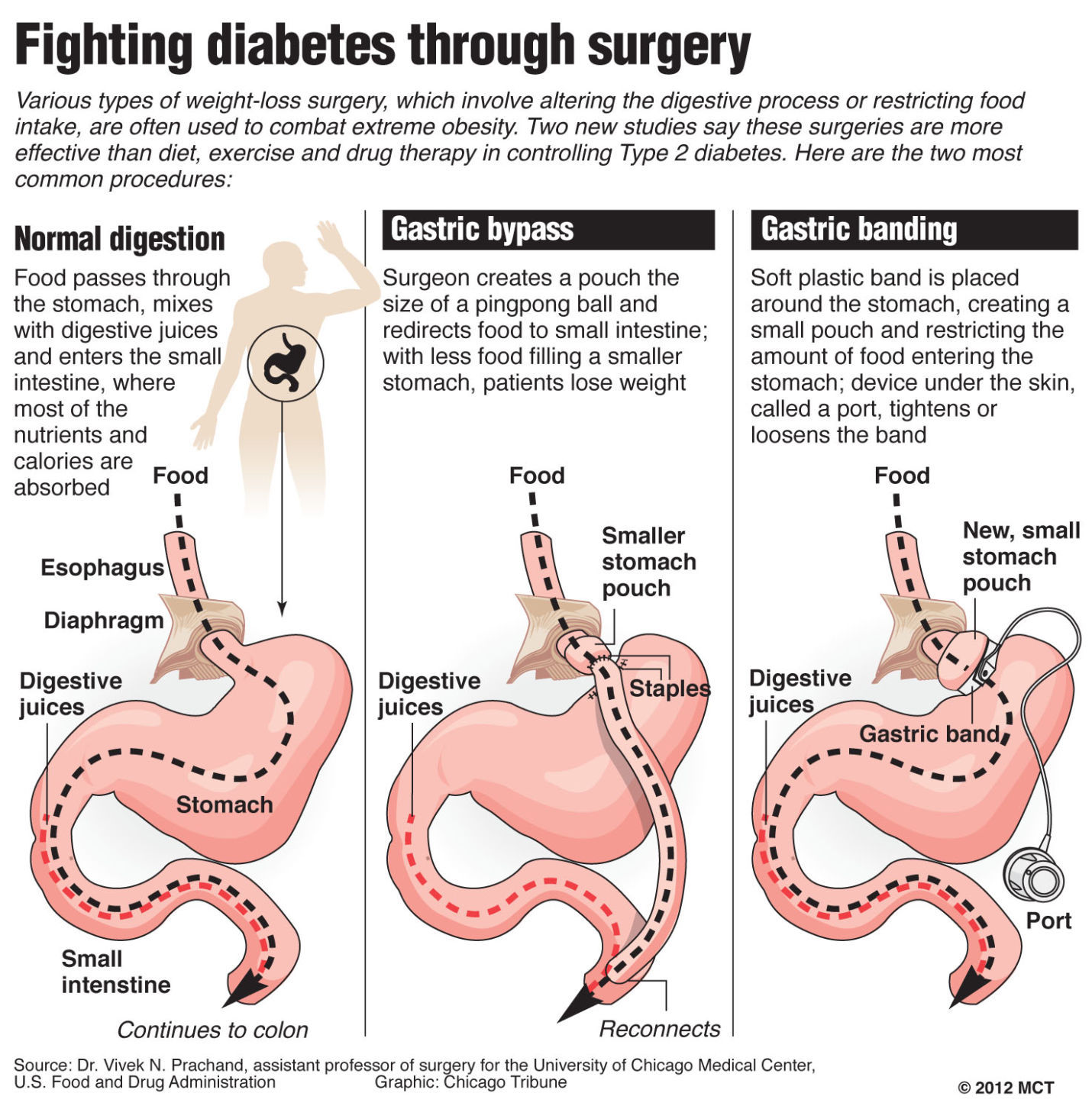 Billings Clinic Accreditation Opens Up Weight Loss Surgery To More Billings Clinic Accreditation Opens Up Weight Loss Surgery To More