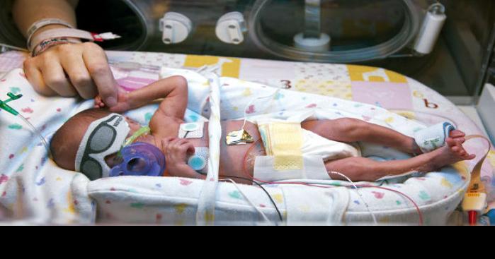 Rare, one in 10,000 monoamniotic twins born at Missoula hospital
