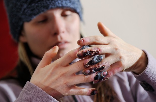 Ice climber returns to sport after severe injury last year