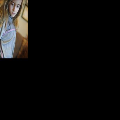 Conjoined twins rise to separate challenges