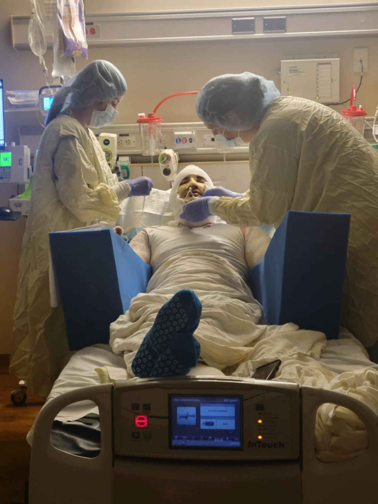 Injured firefighter shares story of Sheridan County wildfire