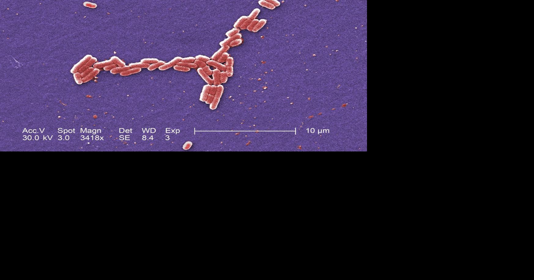 Research: Makeup bags likely filthy with bacteria