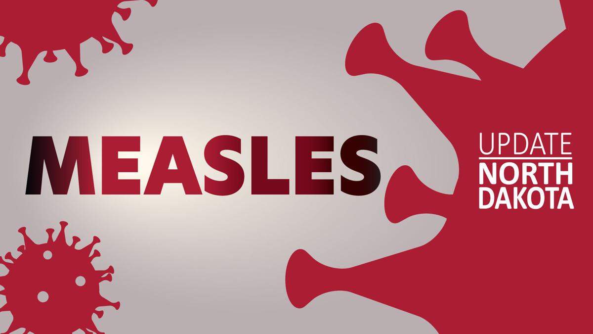 Mealses case confirmed in northwest North Dakota's Williams