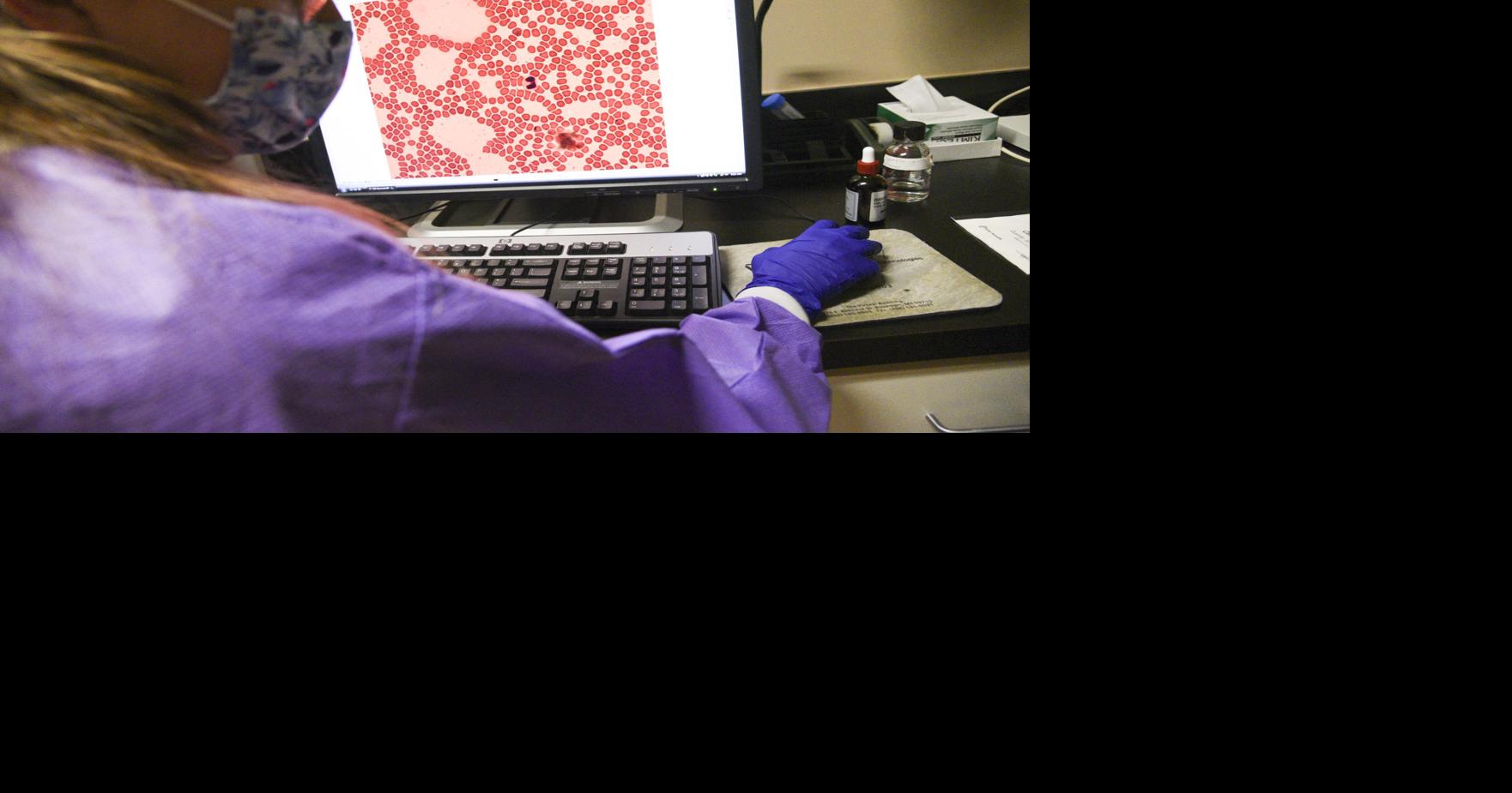 Montana State University researchers study how viruses from bats infect ...