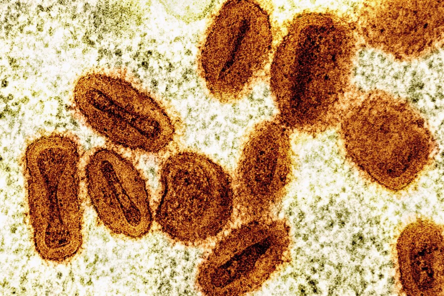 2 scientists charged with bringing deactivated mpox virus into the US ...