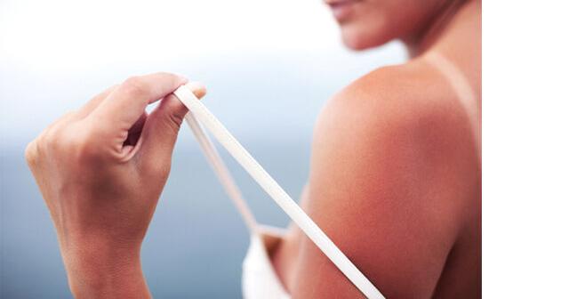 Top 6 most embarrassing (yet common) tan lines