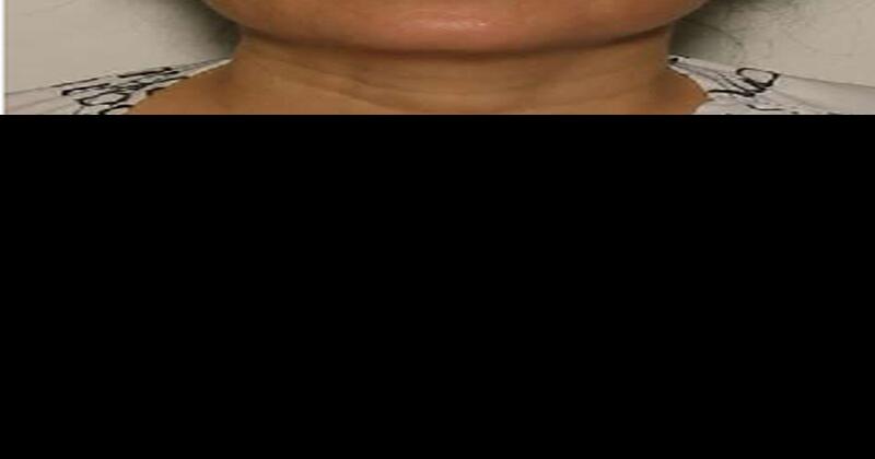 Toronto police announce arrest in murder of lawyer Scott Andrew Rosen