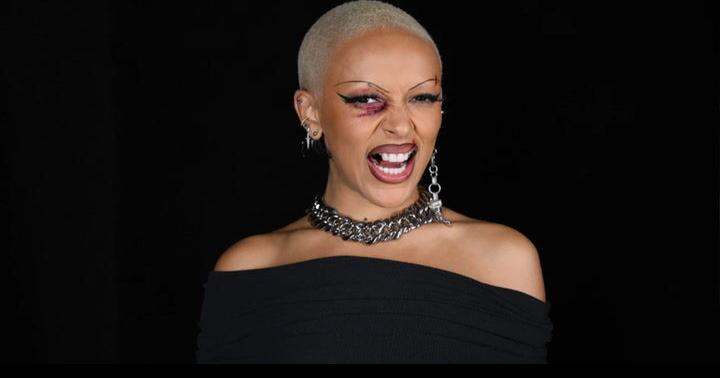 Doja Cat explains her black eye and busted lip look at Paris Fashion Week