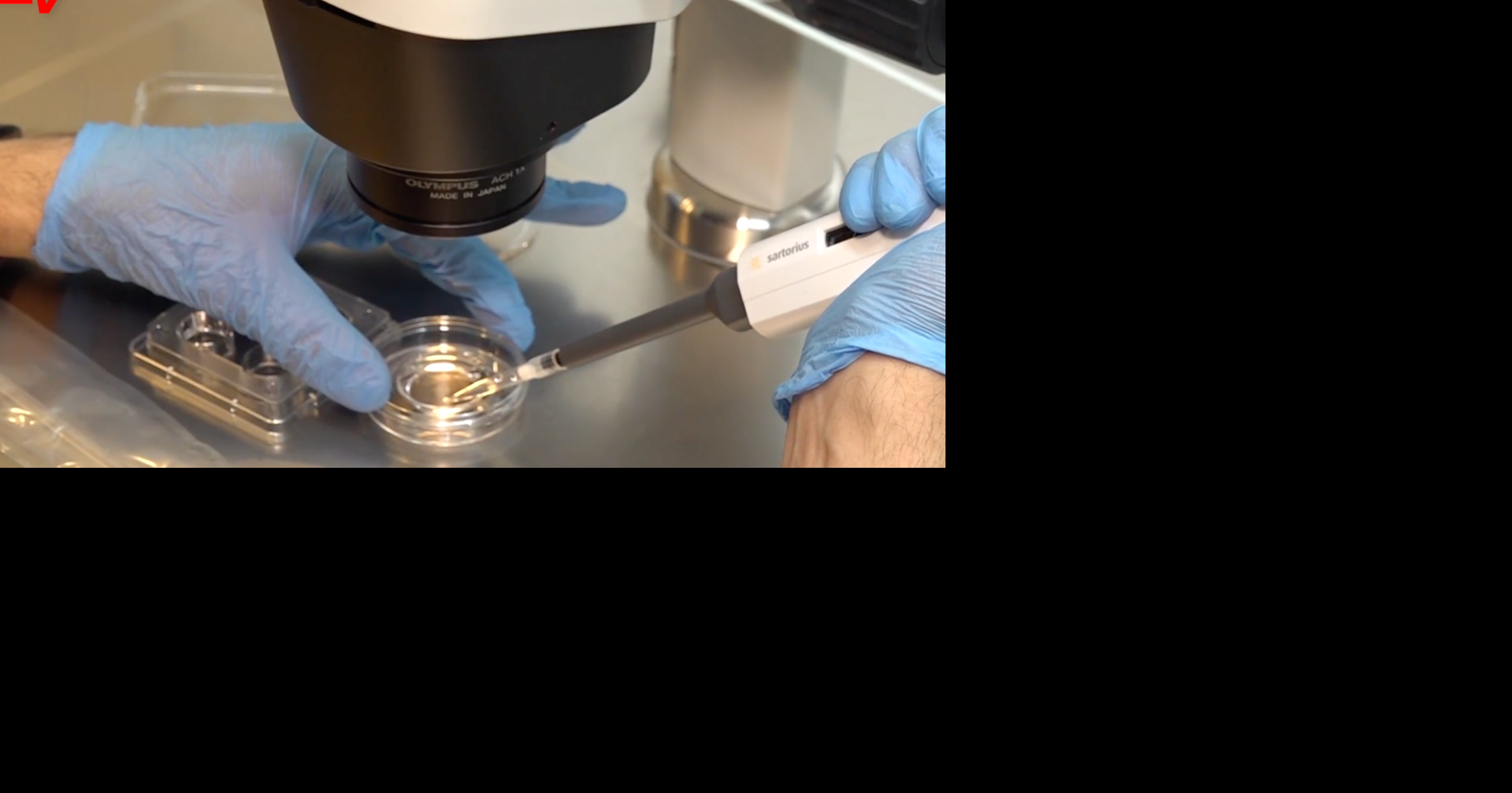 Scientists are studying man who was shot in the head and woke up seeing ...