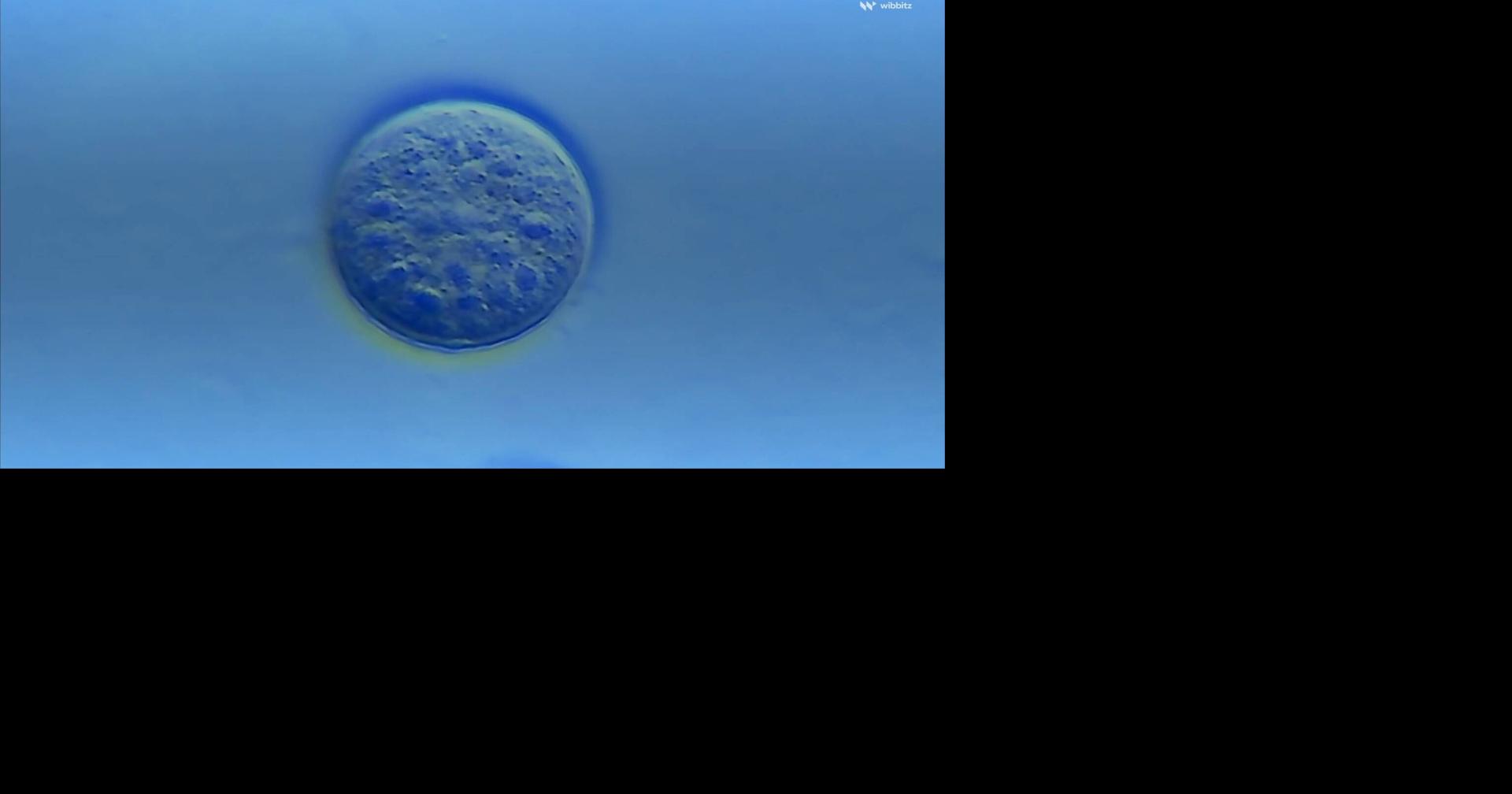 'Synthetic' embryo breakthrough could help solve organ donor problem