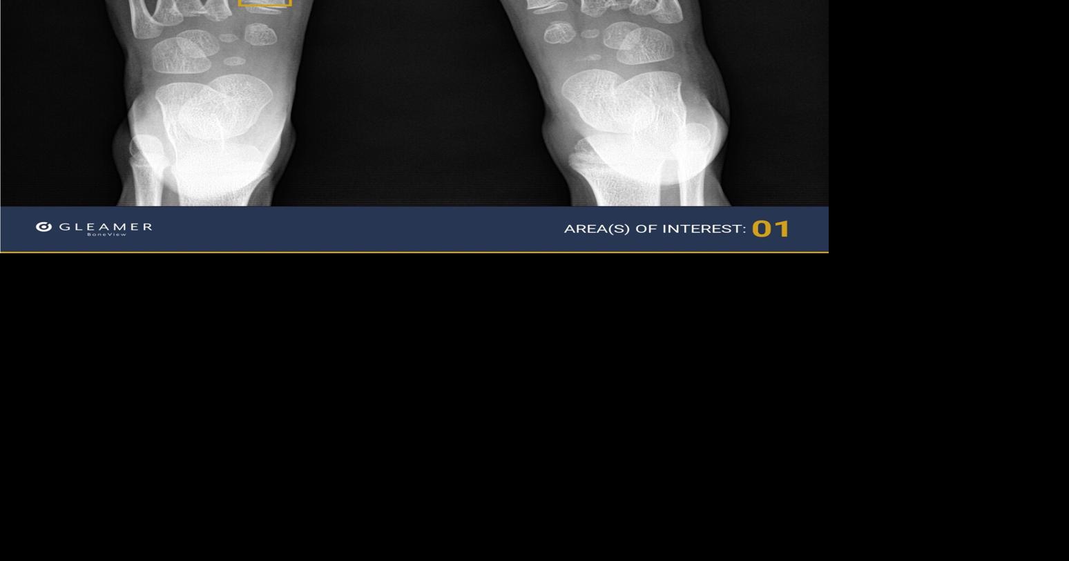 St. Luke's deploys new AI diagnostic tool for ER X-rays | Health news ...