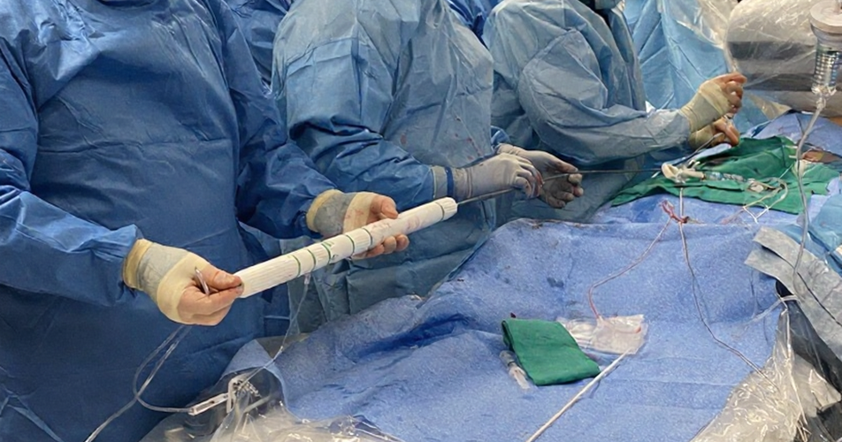 St. Luke’s performs first procedure using ShortCut device for safer ...