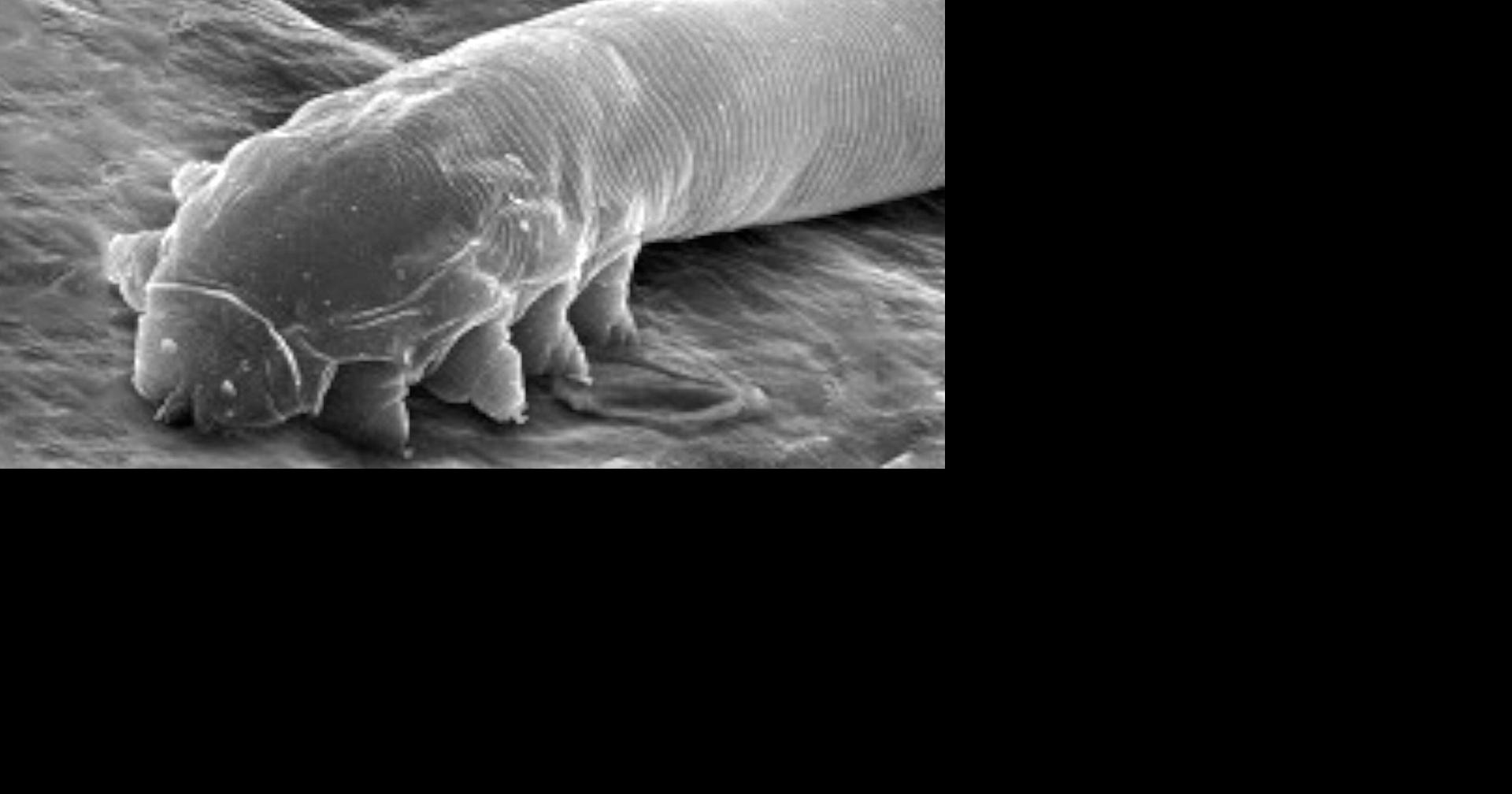 Did you know your face is covered in tiny mites?