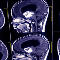 Windsong Radiology acquires Buffalo MRI