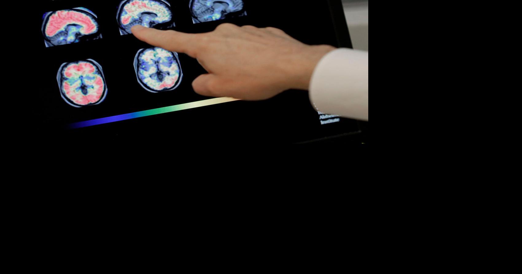 Sally Pipes: Don’t blame America's health system for decline in life ...