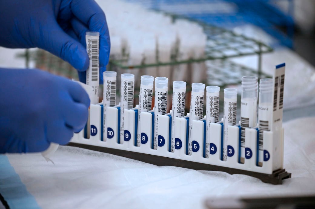 Coronavirus testing expands in the region – but not yet for everyone