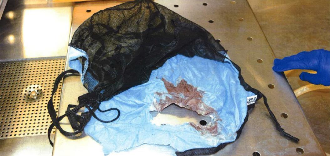 Jail deputies in inmate death testify they knew little about 'spit masks'