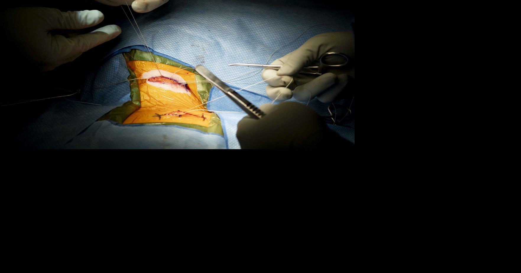Two small incisions