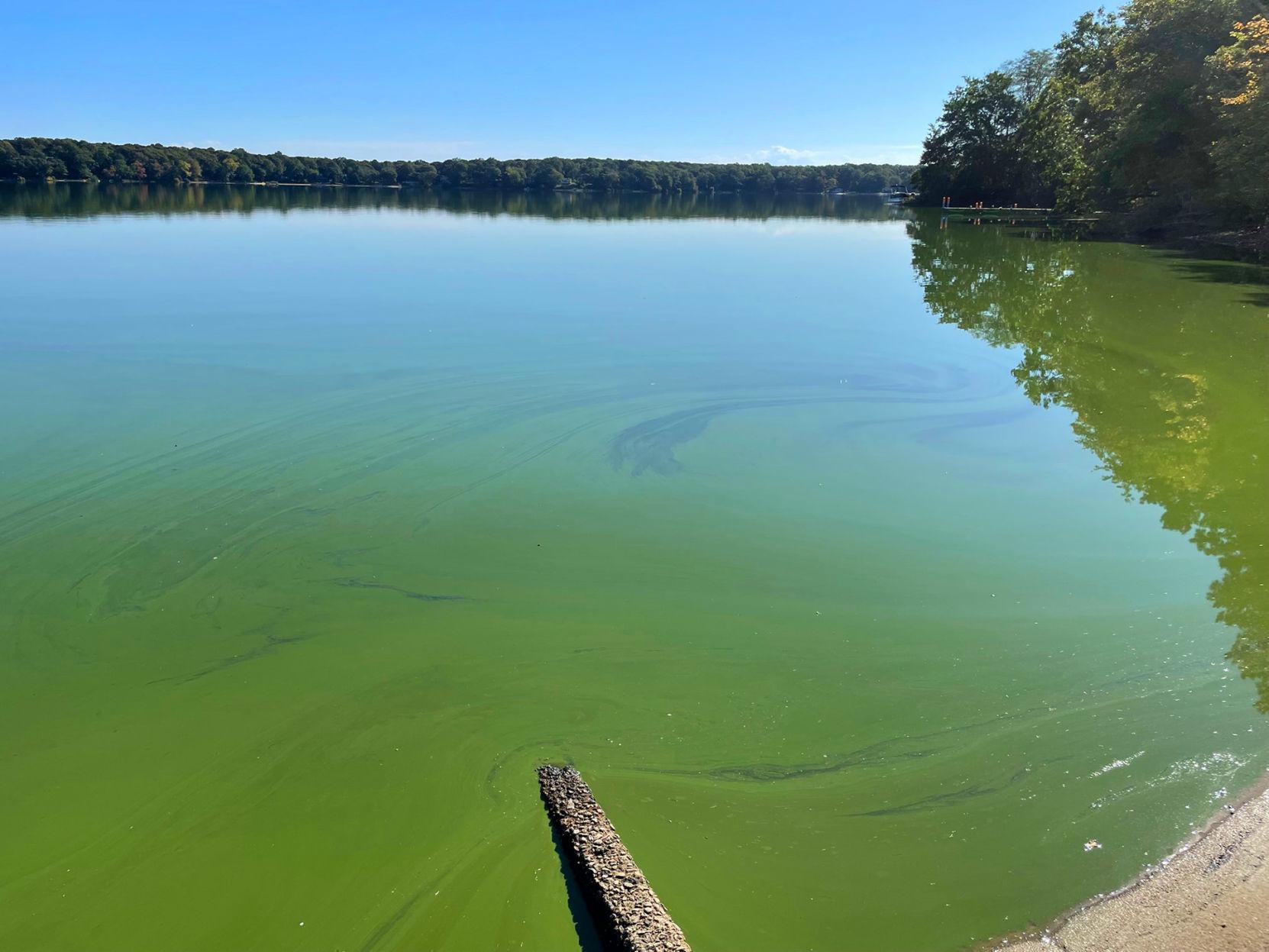 Ashumet Pond In Bad Shape During Continued Cyanobacteria Warning ...