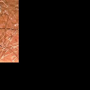 Our Outdoors: on guard against flora & fauna | News | capjournal.com