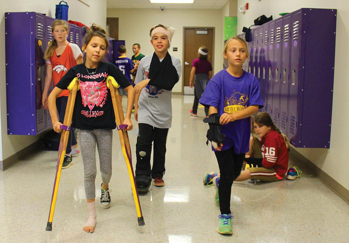 Faking injuries for homecoming | News | capjournal.com