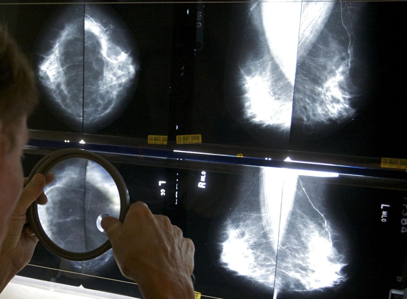 Wisconsin Biohealth Tech Hub bustling with Biden era funding | Health ...