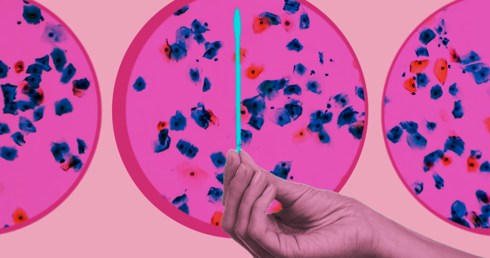 Cervical cancer is on the rise. This doctor wants to talk about why ...