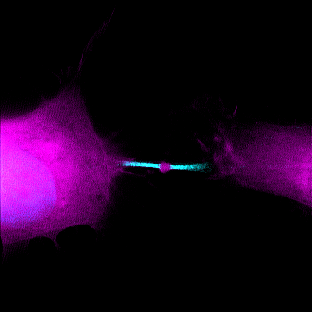 UW-Madison's WARF seeks next research wins amid federal cuts ...