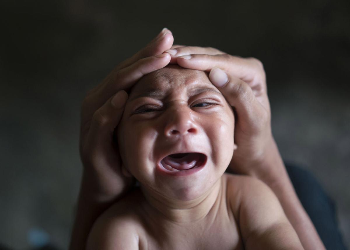 No proof Zika causes microcephaly, UW-Madison study says