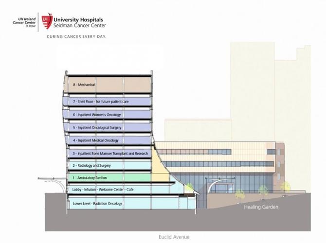 Uh Seidman Cancer Center To Offer Cutting Edge Care Find This Article