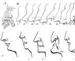 Nasal politics: revisiting myth of the Jewish nose | Find this article ...