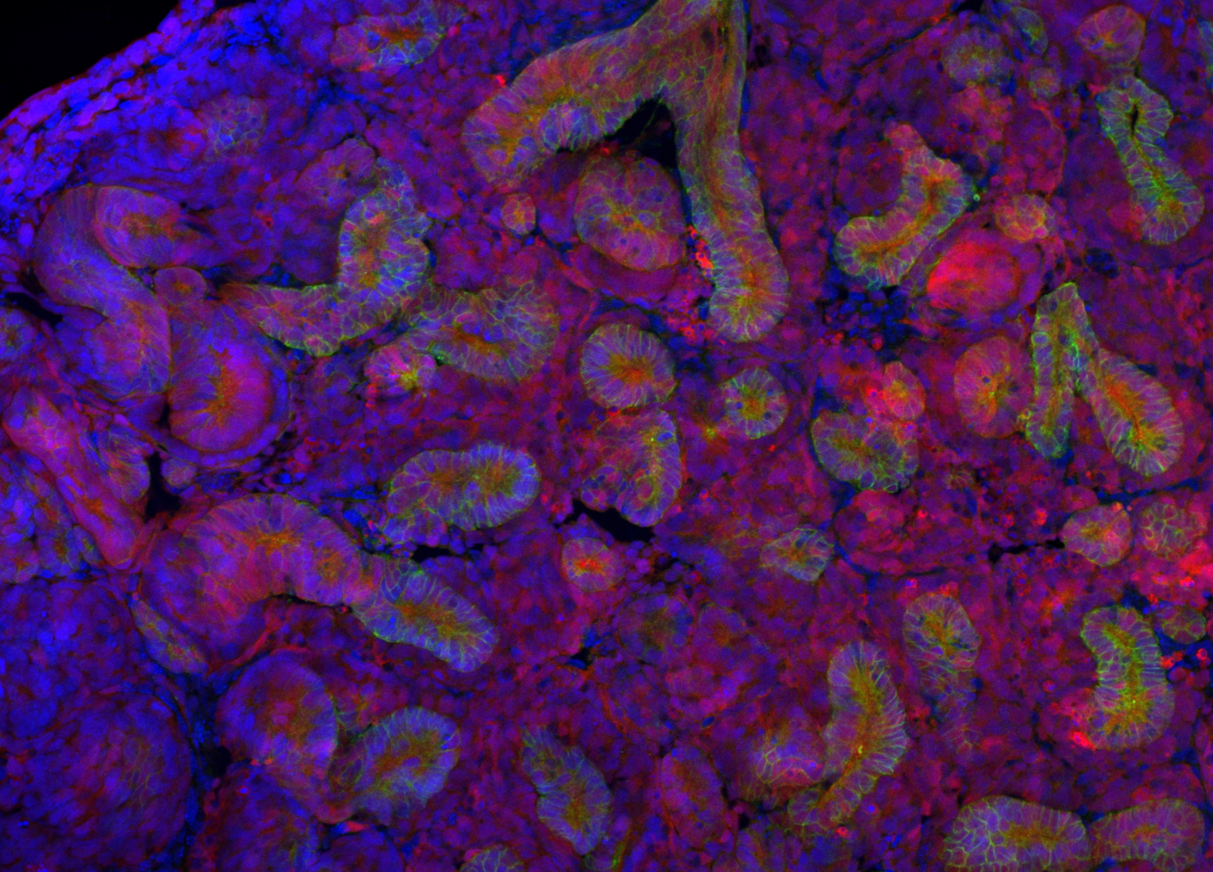 Rat kidneys grown in mice offer new hope for transplant patients ...