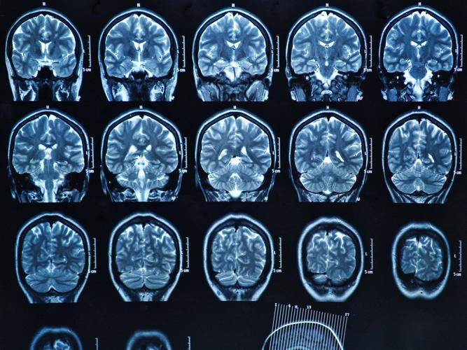Understanding Overdose: The physiology of drug use and overdose