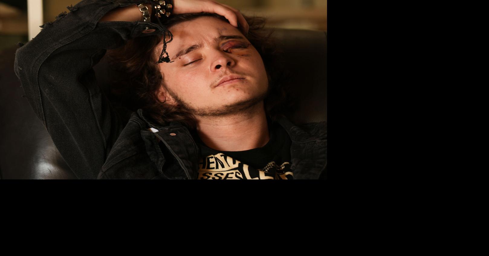 Demonstrator injured after federal agent fired projectile