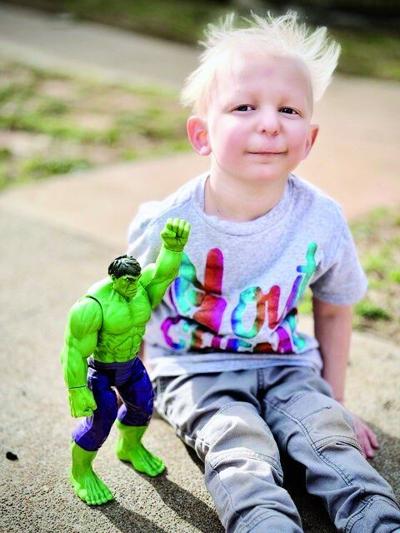 Smashing cancer: 4-year-old Hulk enthusiast wins fight with aggressive ...