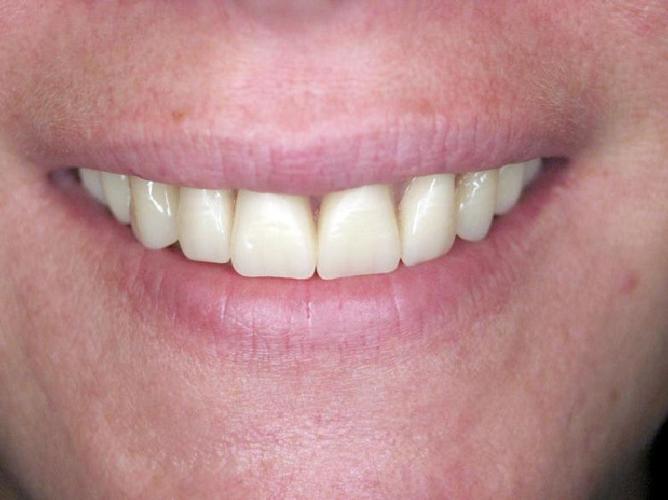 Woman treated to new look | News | dailyitem.com