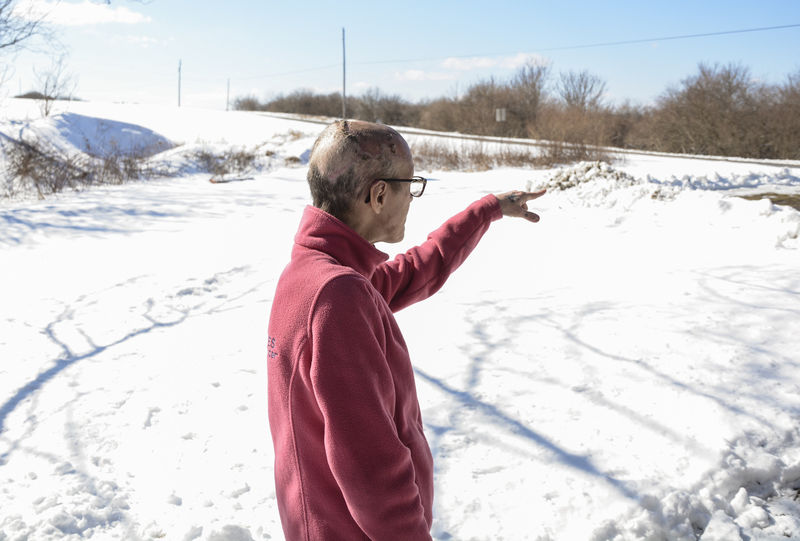 Bear attack victim recounts harrowing ordeal | Local News | dailyitem.com