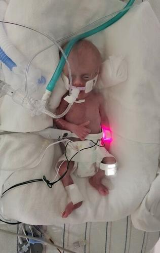 Great care needed for the smallest of babies | News | dailyitem.com